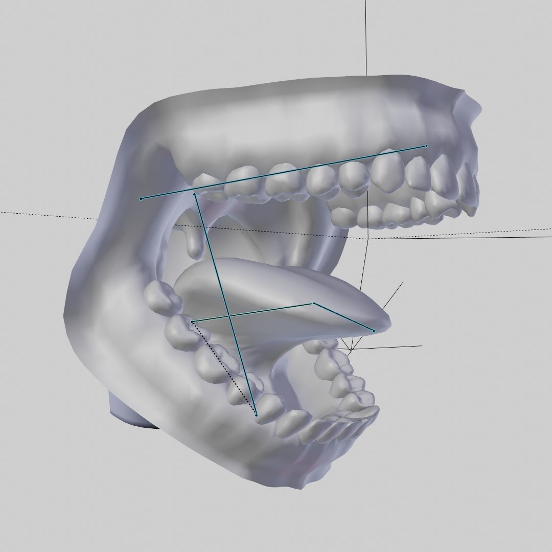 3D human mouth teeth model - TurboSquid 1278134