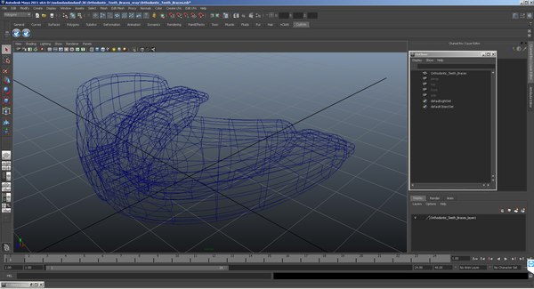 치아 교정 치아 교정기 3D 모델 - TurboSquid 1318075