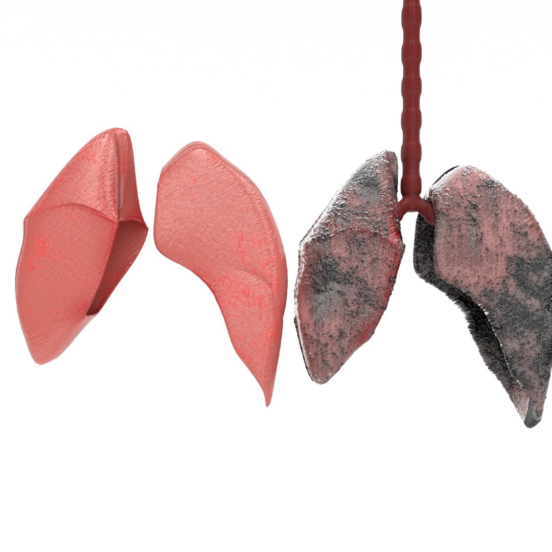 3D Healthy Smoker Lungs Model - TurboSquid 1685184