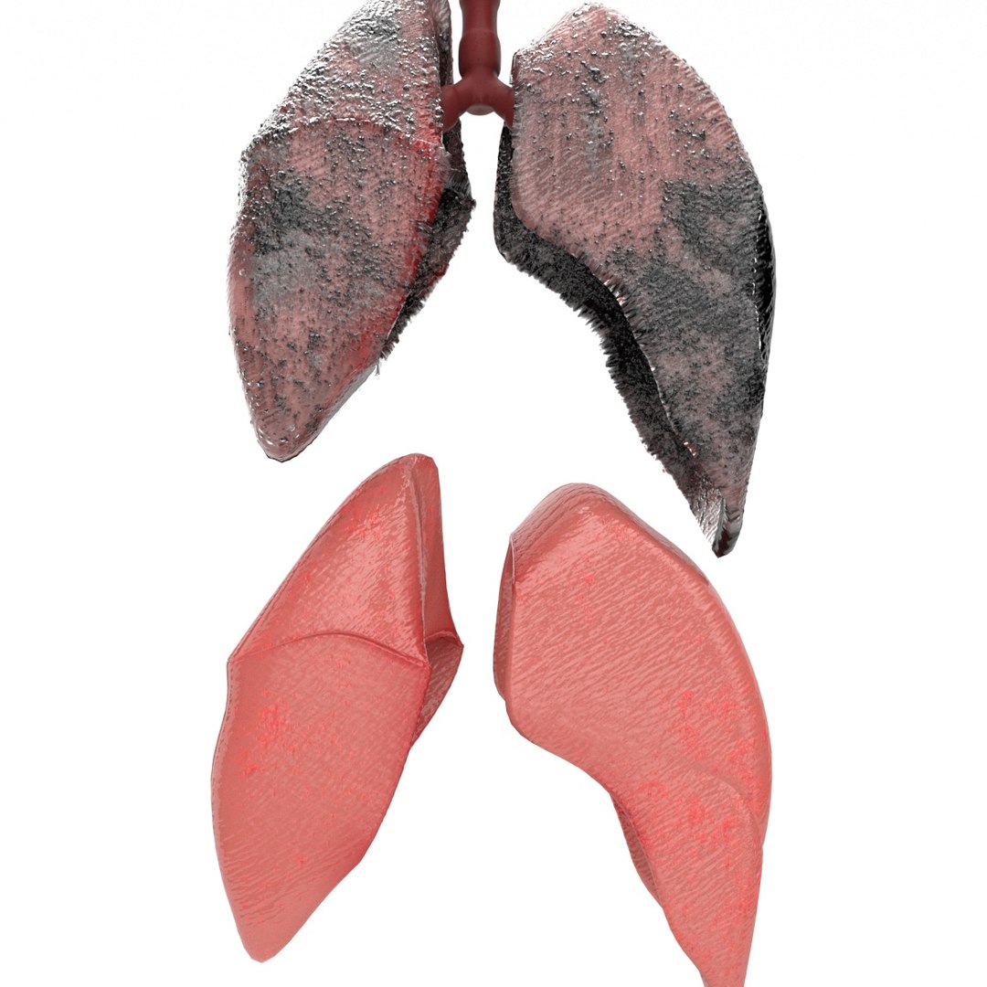 3D Healthy Smoker Lungs Model - TurboSquid 1685184