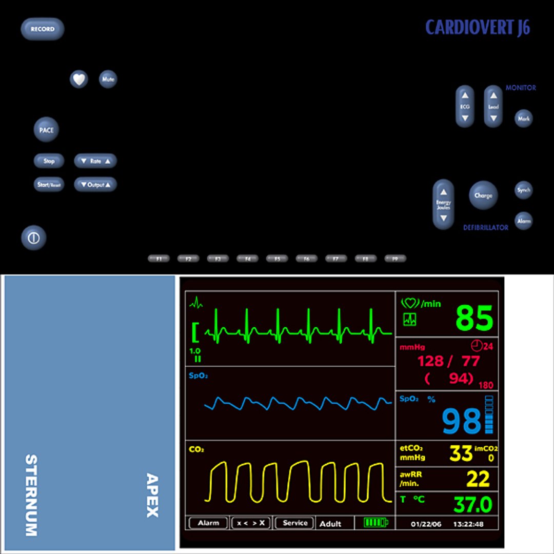 Cardiac Defibrillator Crash Cart 3d Model
