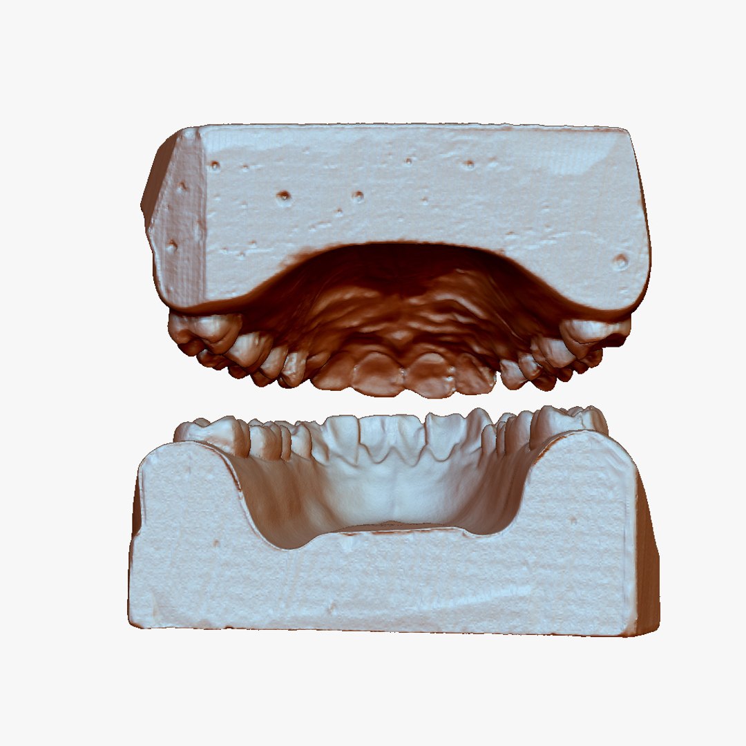 Gypsum Teeth 3d Max