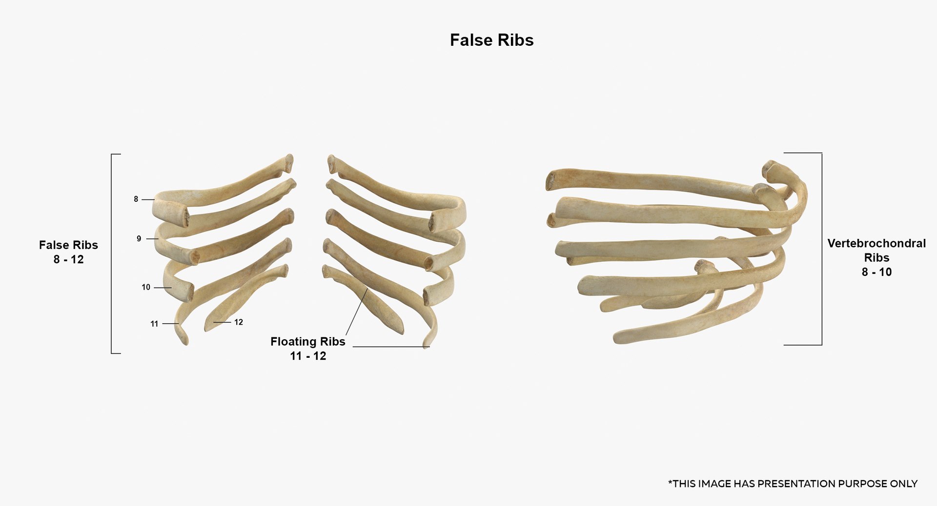 Human Rib Cages Spines and Female Pelvis Bones Yellow Collection 01 - 2 ...