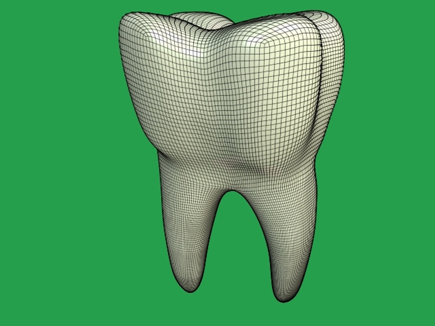 Tooth Dental 3d Obj