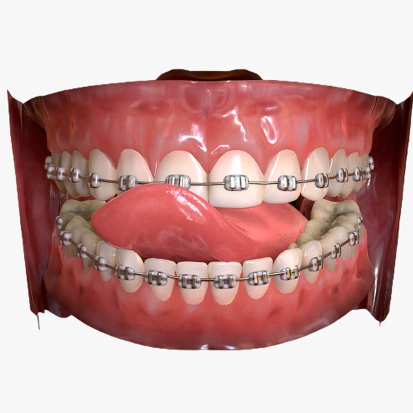 realistic orthodontic anatomy mouth max