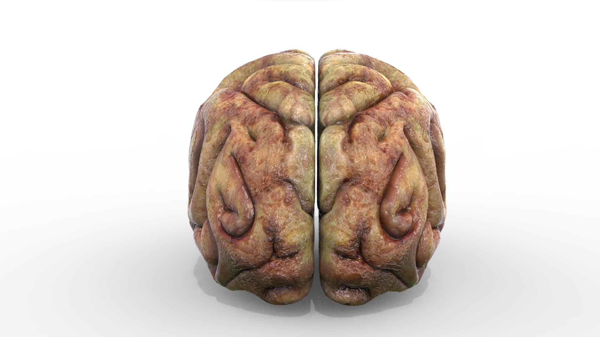 3D Gory Human Brain Damaged - TurboSquid 2068081