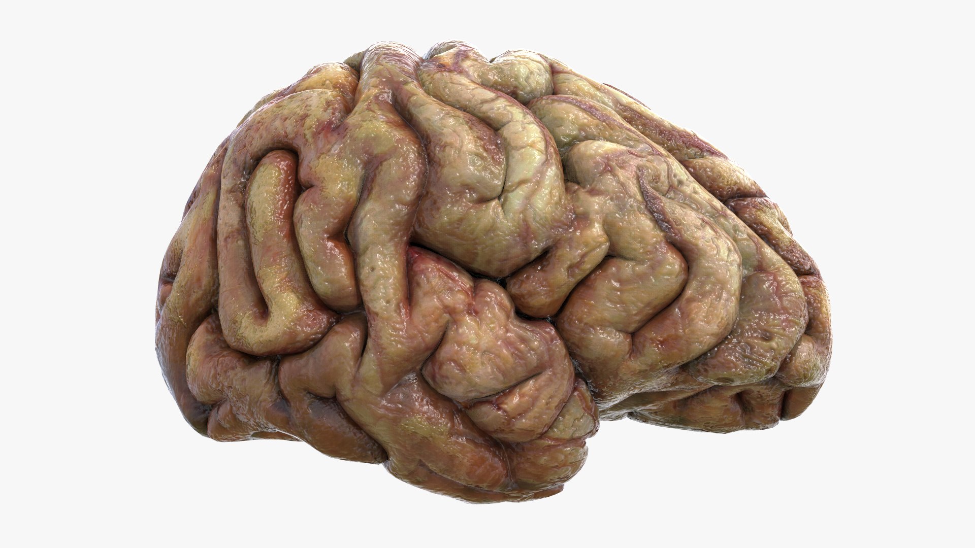 3D Gory Human Brain Damaged - TurboSquid 2068081