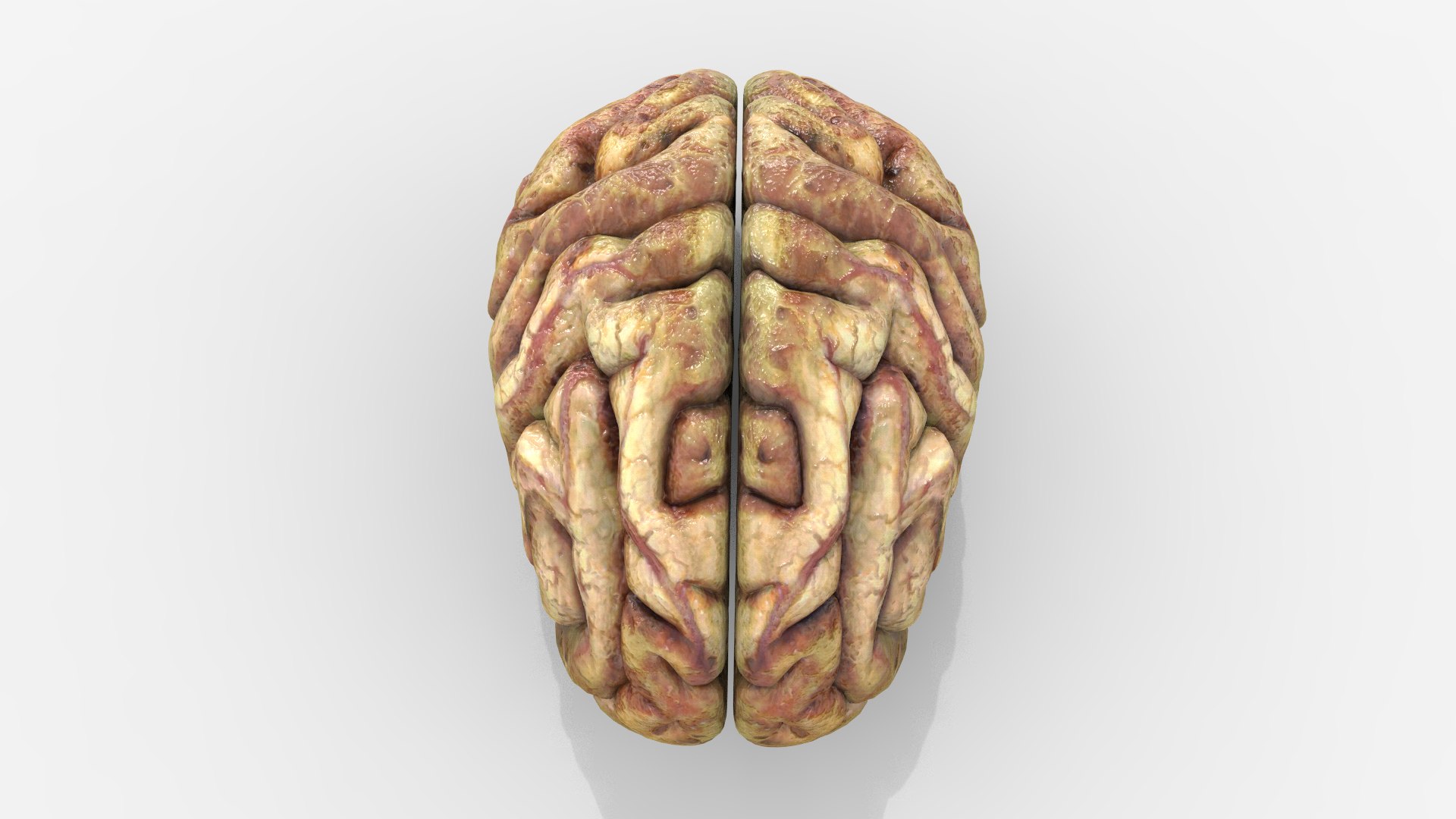 3D Gory Human Brain Damaged - TurboSquid 2068081