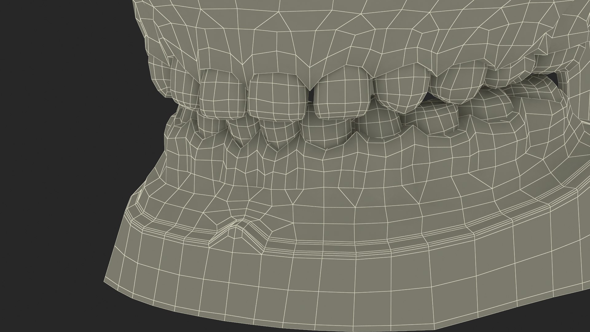 Manikin Dental Typodont Pediatric Model with Removable Overbite Teeth ...