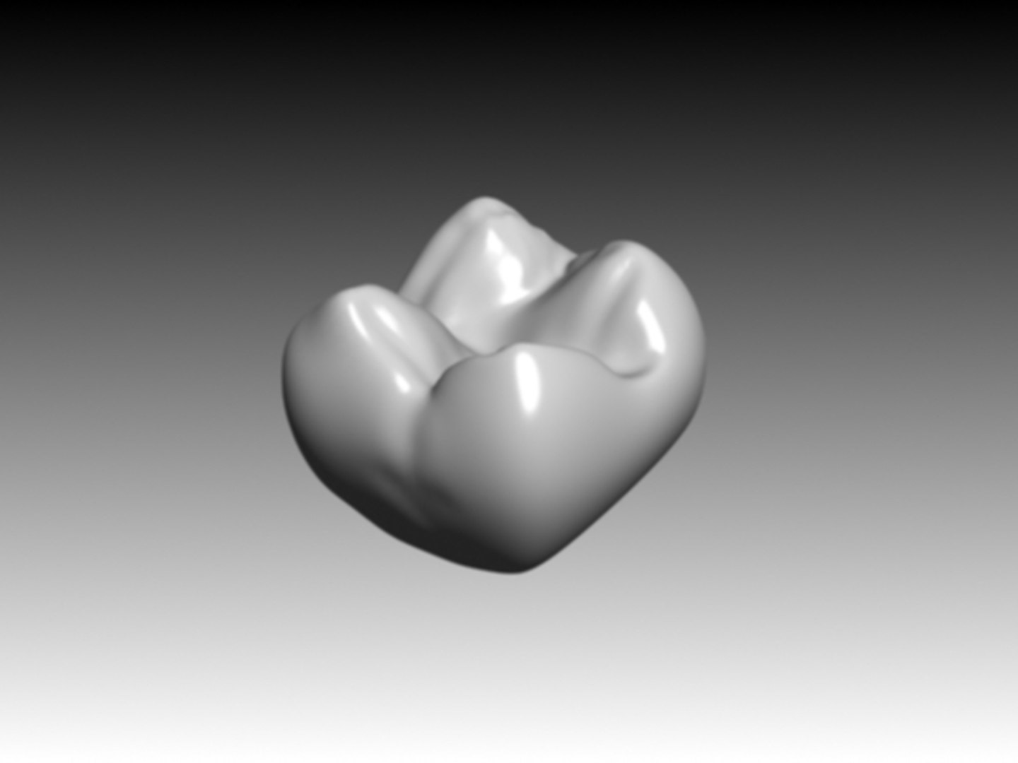 3d second molar mandibular