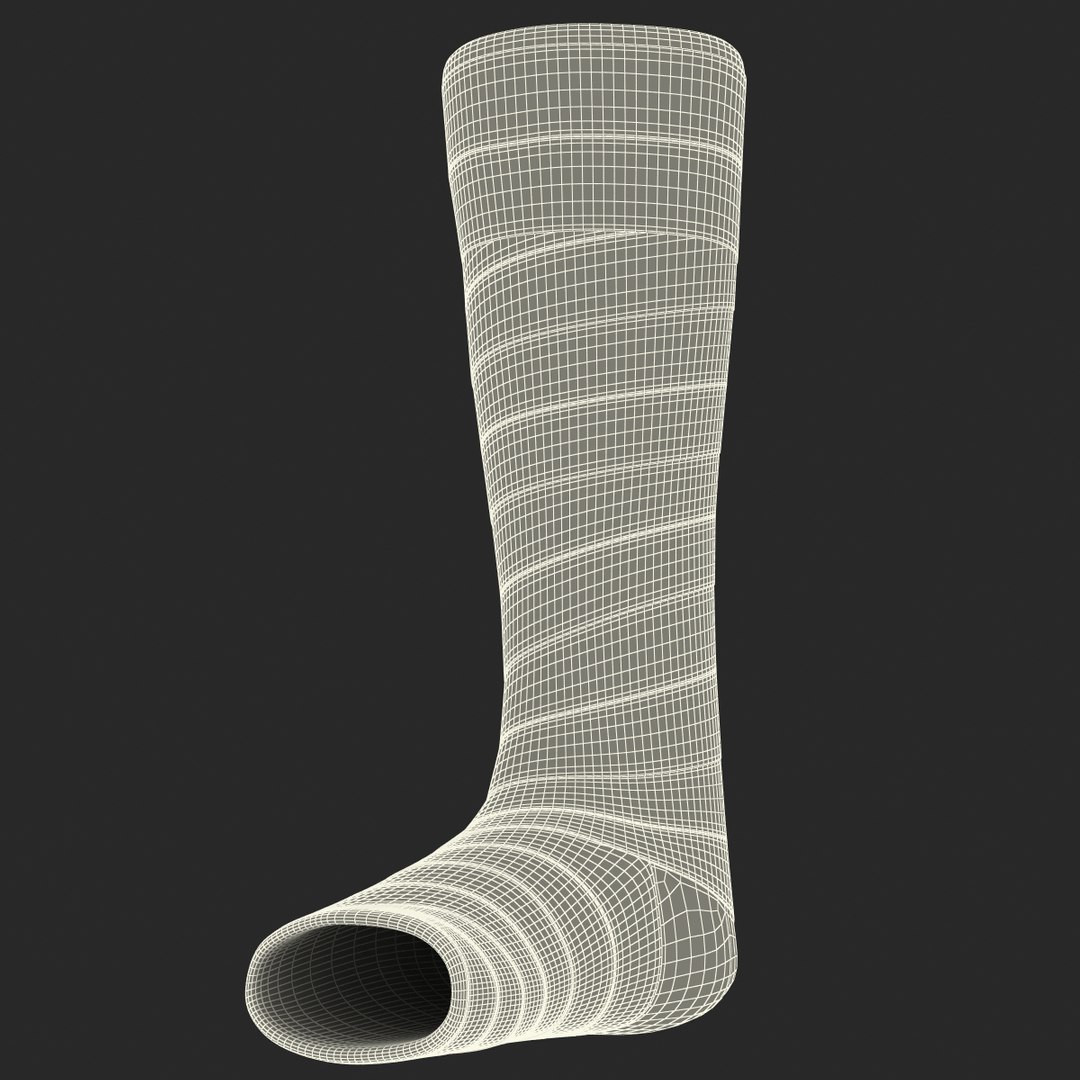 Max Blue Fiberglass Cast Leg