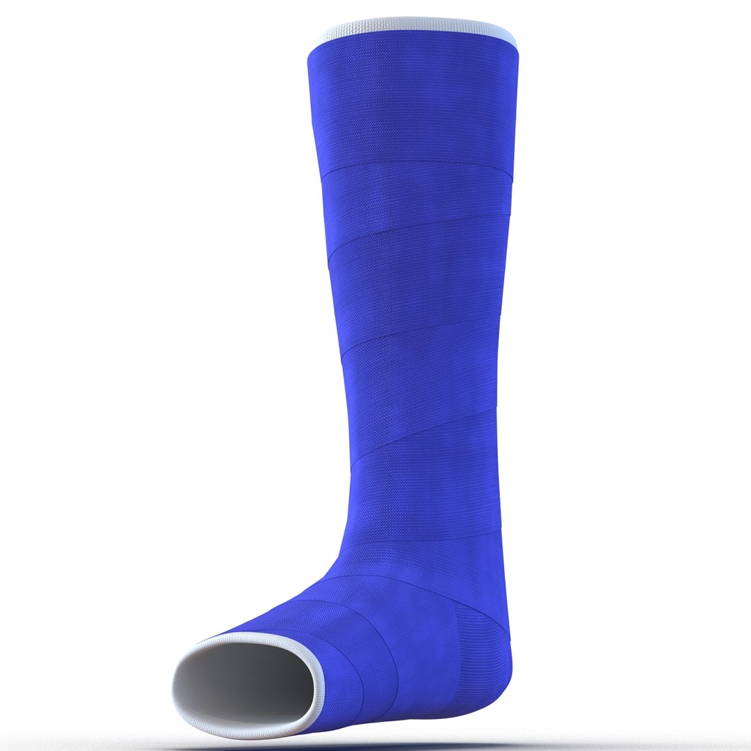 max blue fiberglass cast leg