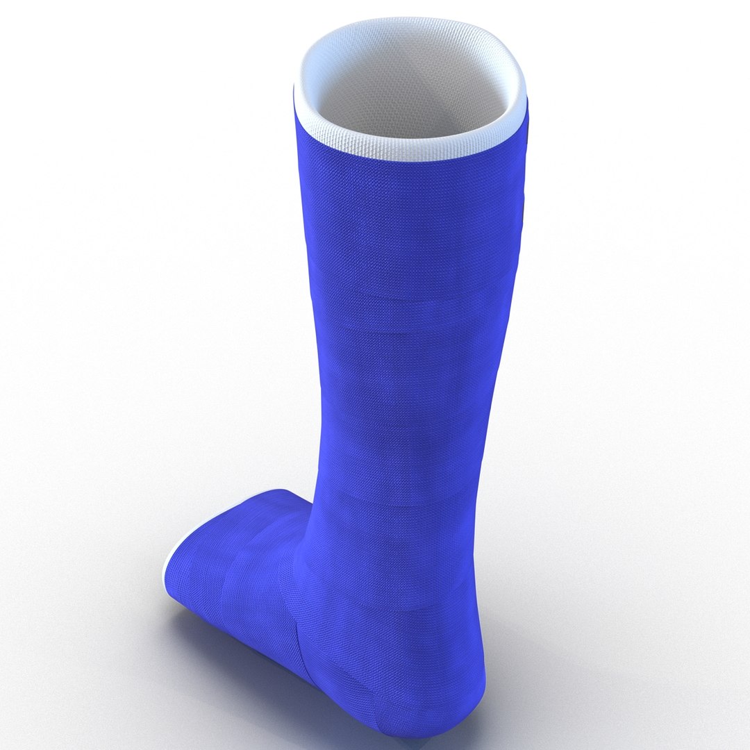max blue fiberglass cast leg