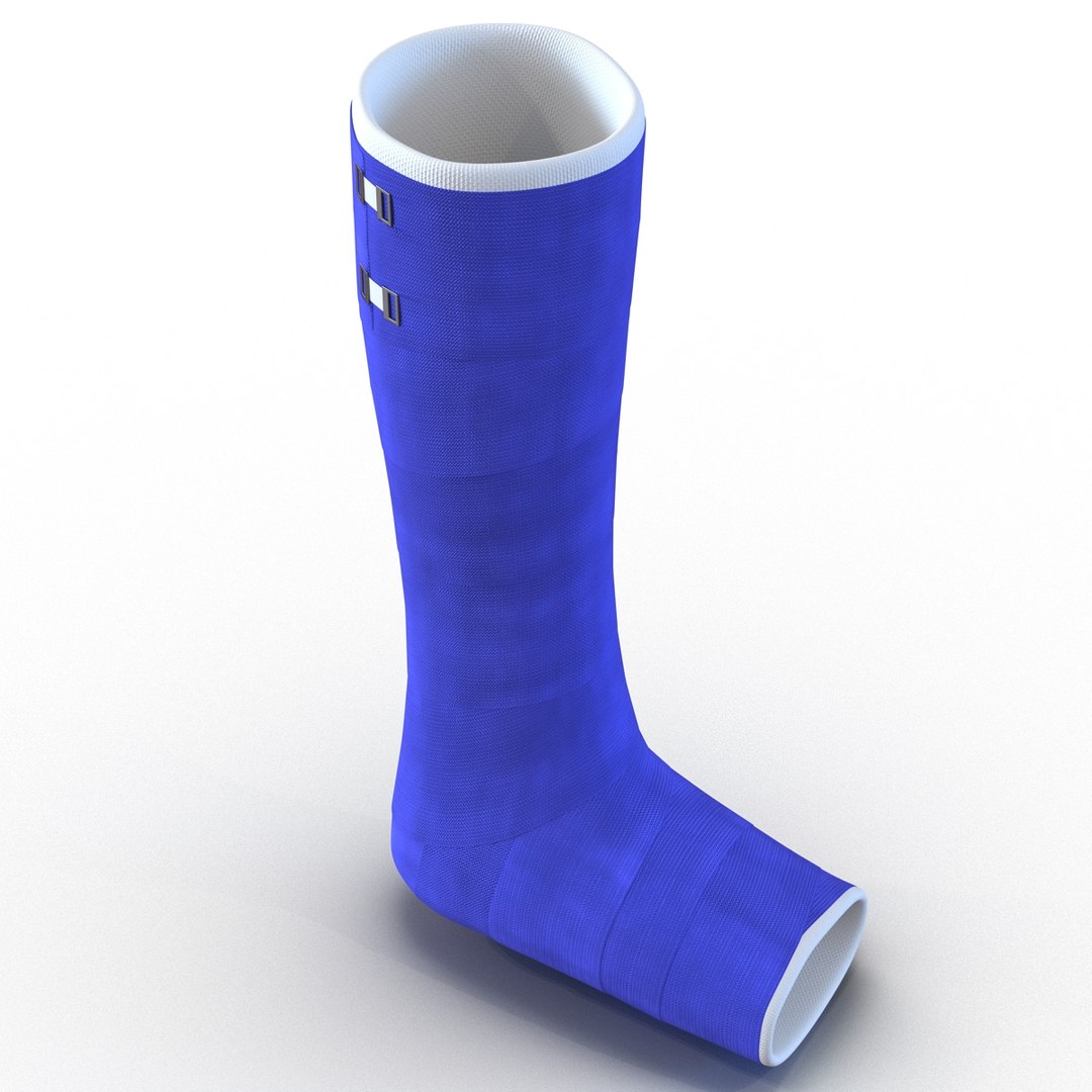 max blue fiberglass cast leg