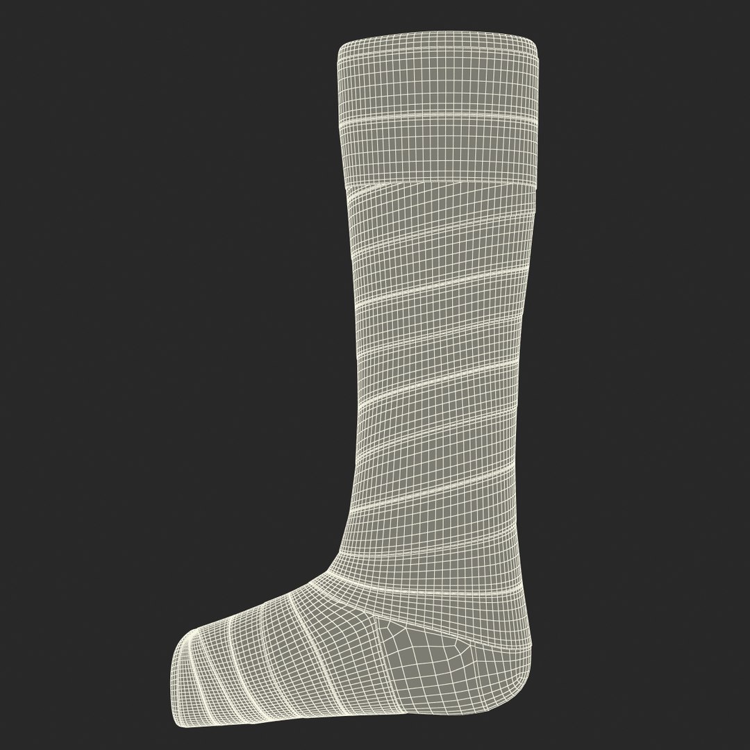 Max Blue Fiberglass Cast Leg