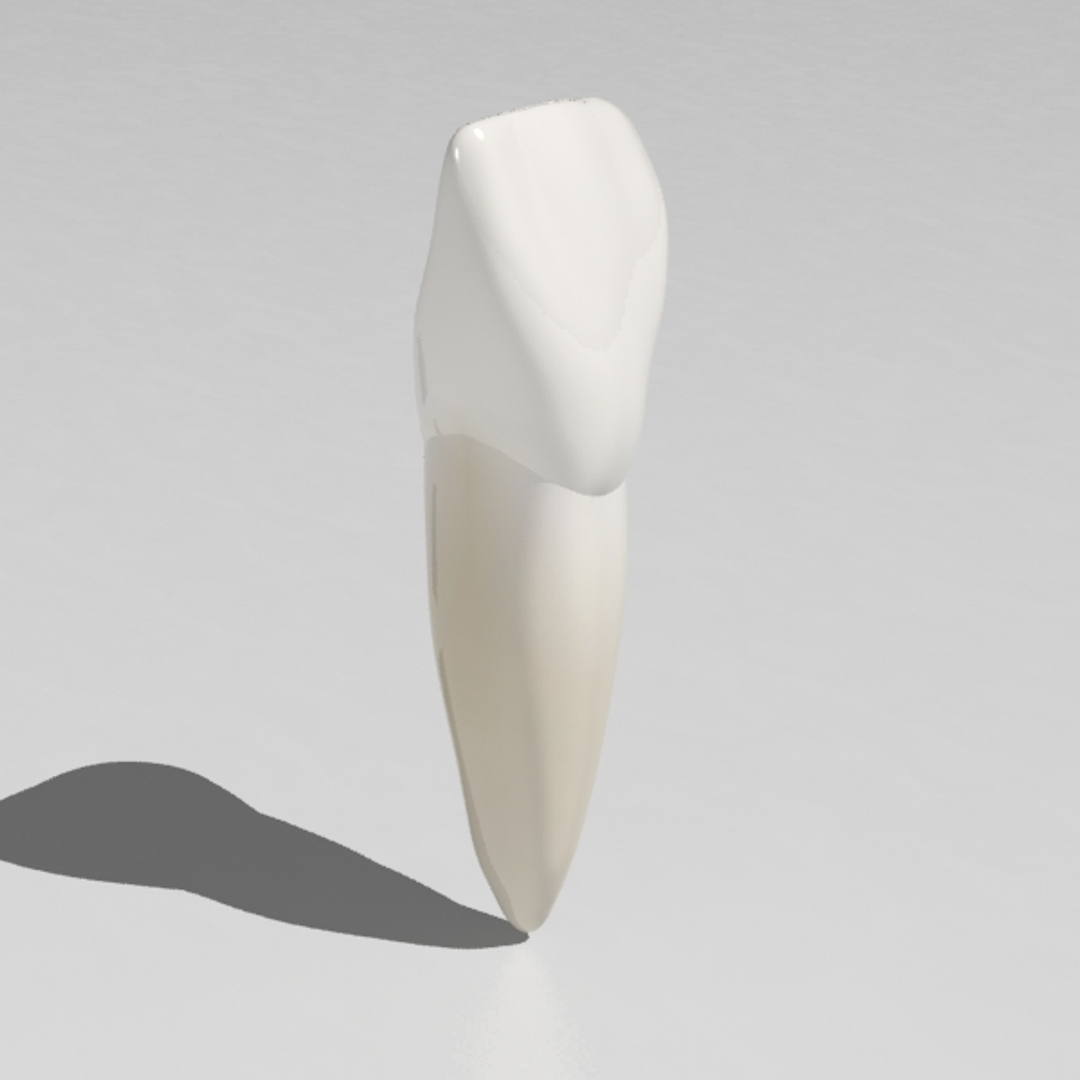 3d lateral incisor