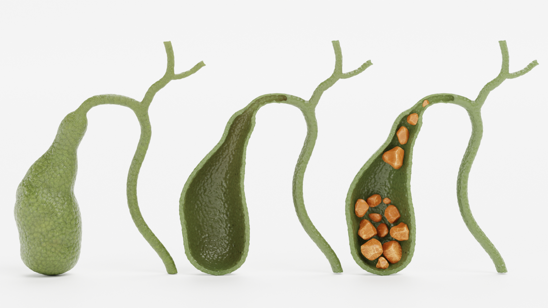 3D Gallbladder Set - TurboSquid 1756742