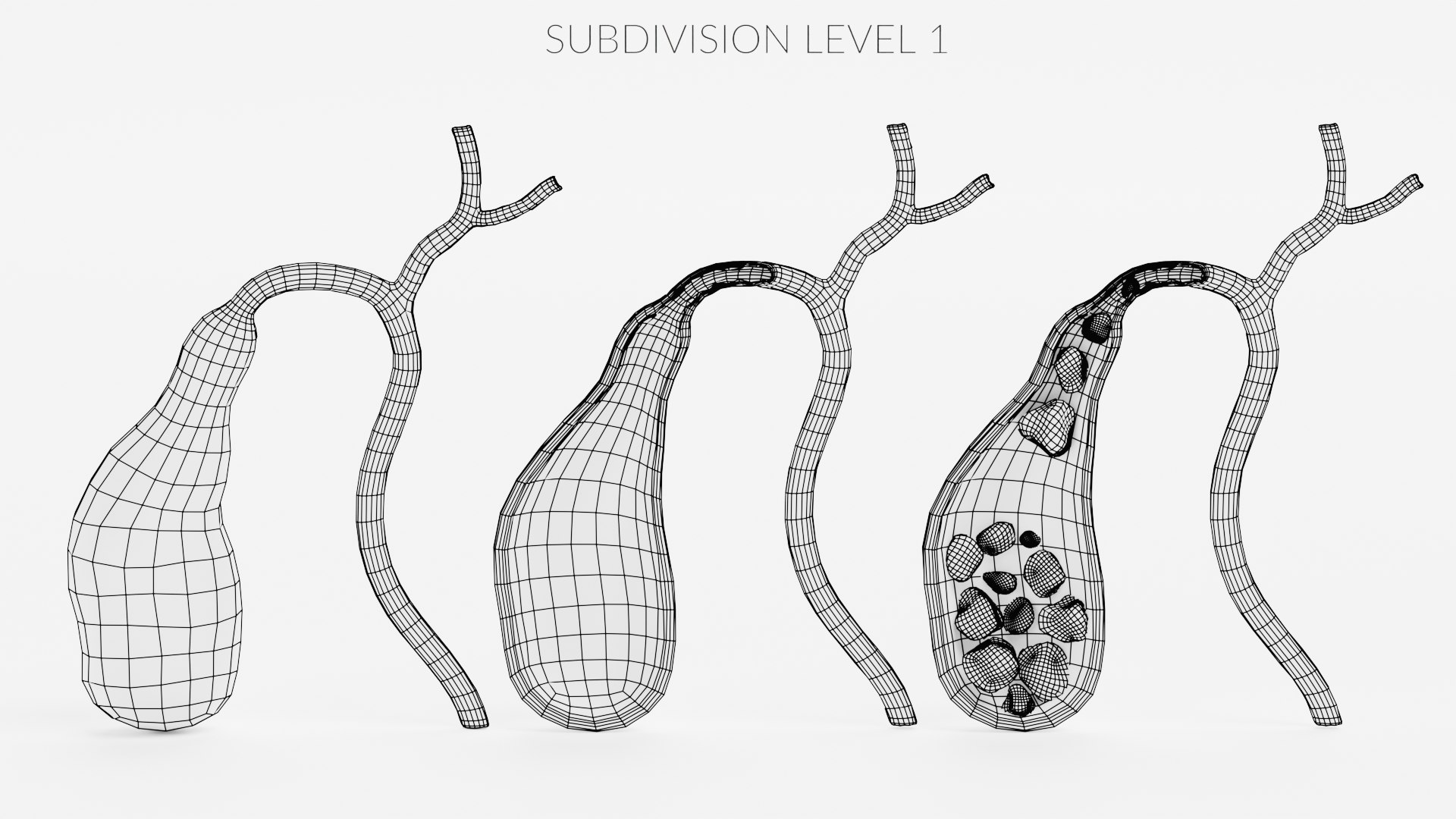 3D Gallbladder Set - TurboSquid 1756742