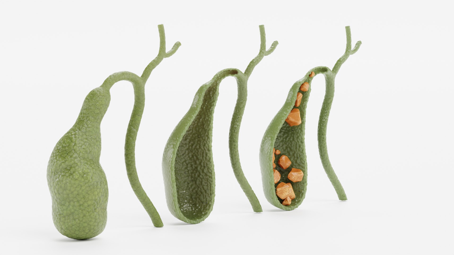 3D Gallbladder Set - TurboSquid 1756742
