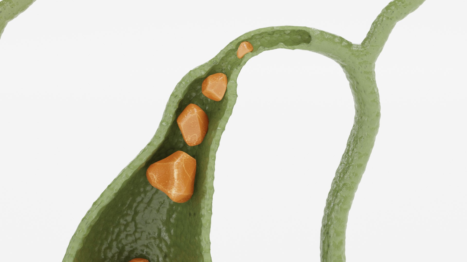 3D Gallbladder Set - TurboSquid 1756742