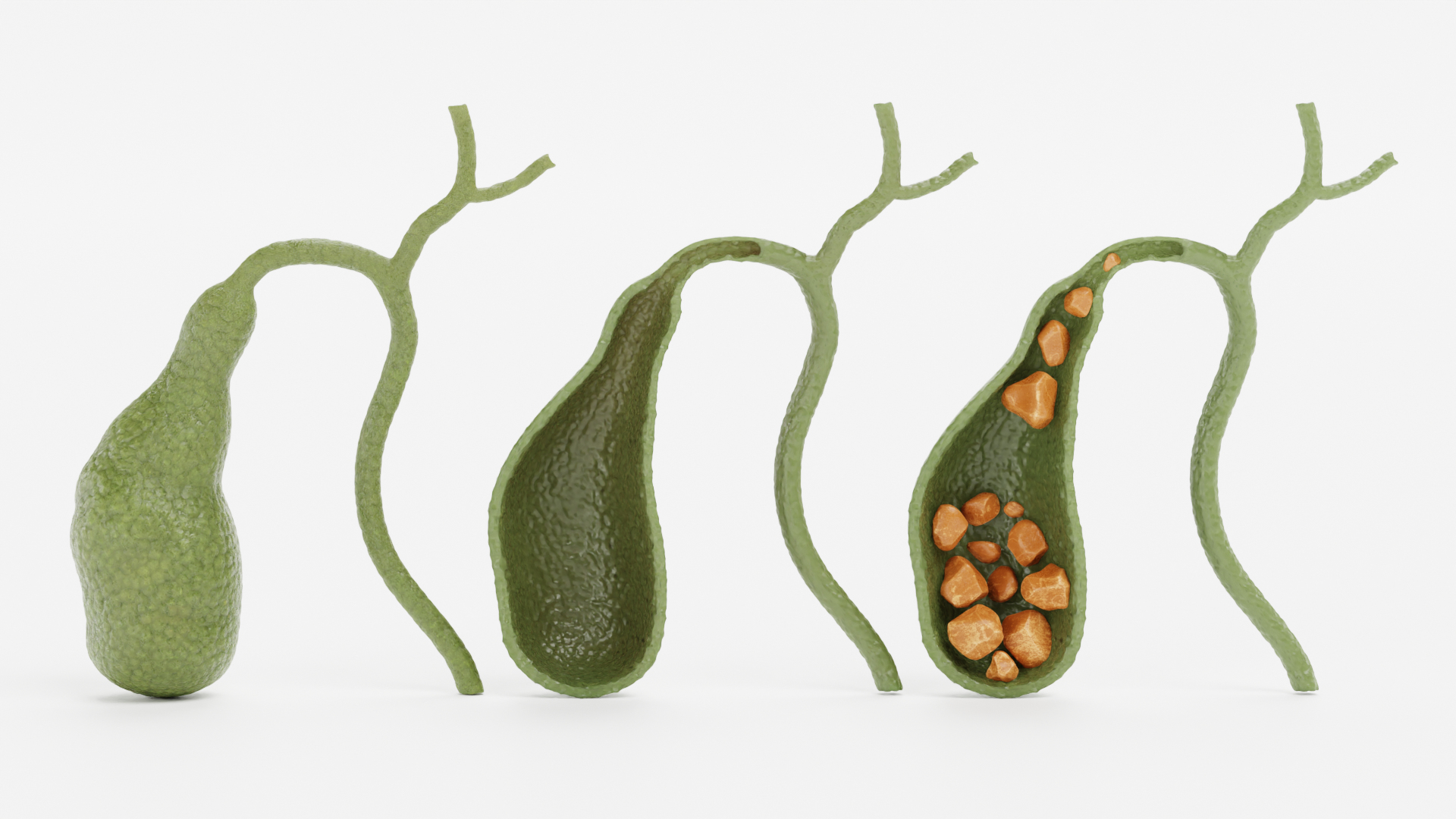 3D Gallbladder Set - TurboSquid 1756742