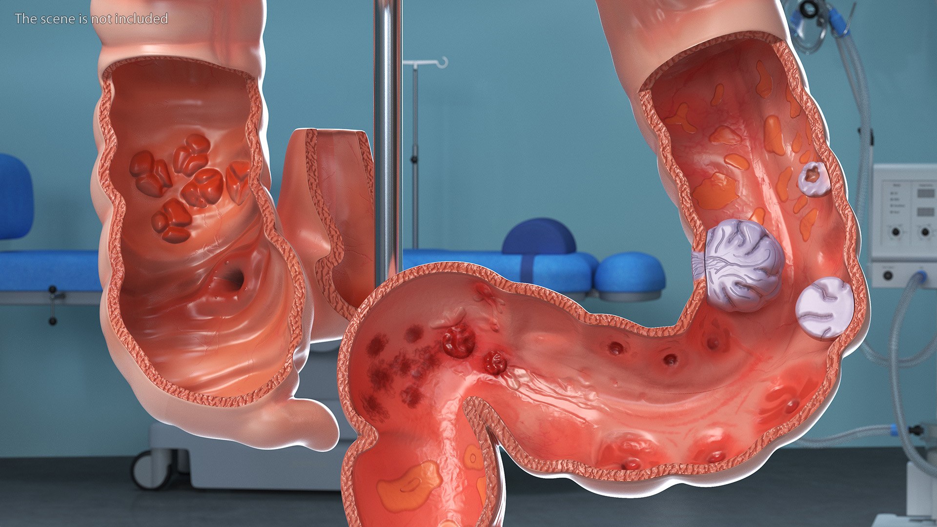 3D Medical Models Collection 5 model - TurboSquid 2122530