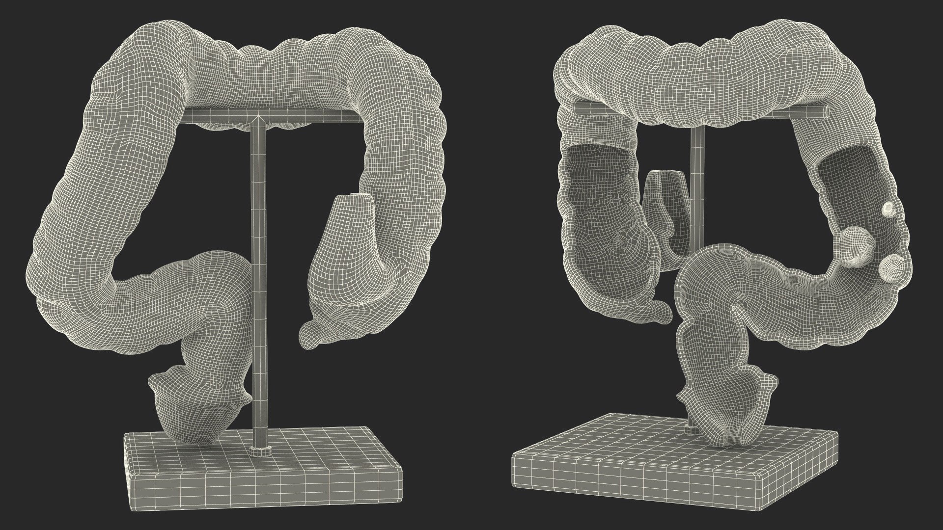 3D Medical Models Collection 5 model - TurboSquid 2122530