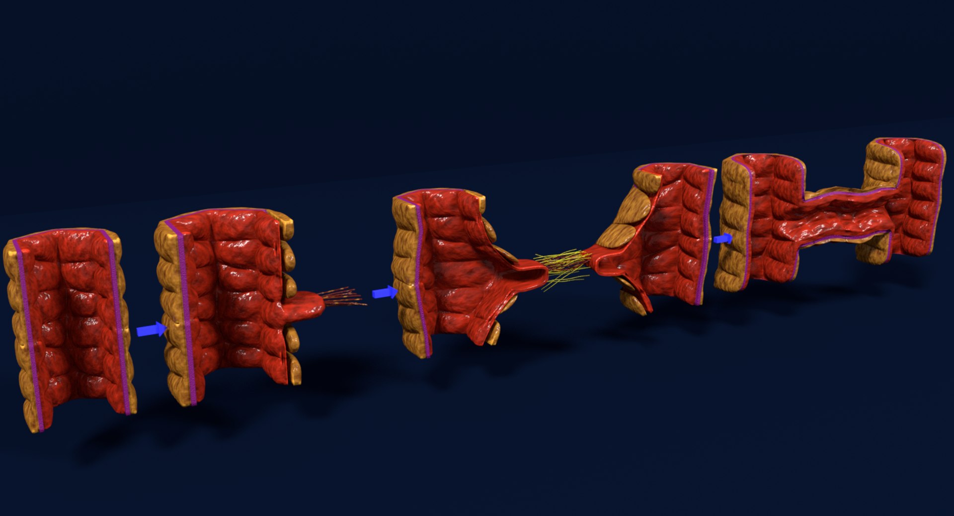 3D Angiogenesis - TurboSquid 1557420