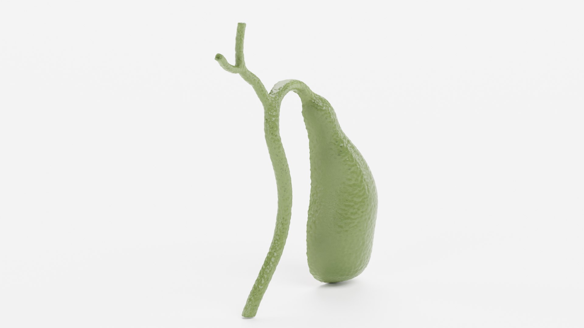 Gallbladder with Gallstones model - TurboSquid 1756732