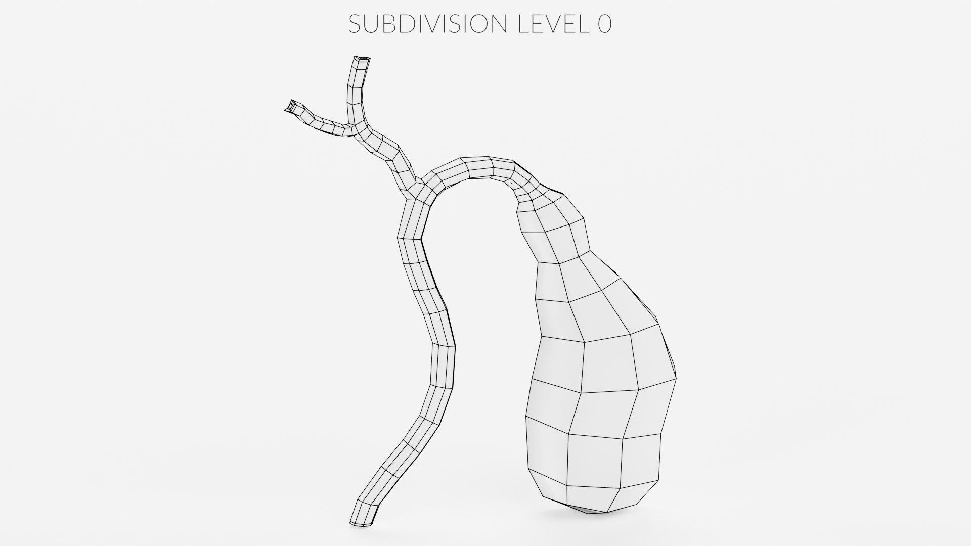 Gallbladder with Gallstones model - TurboSquid 1756732
