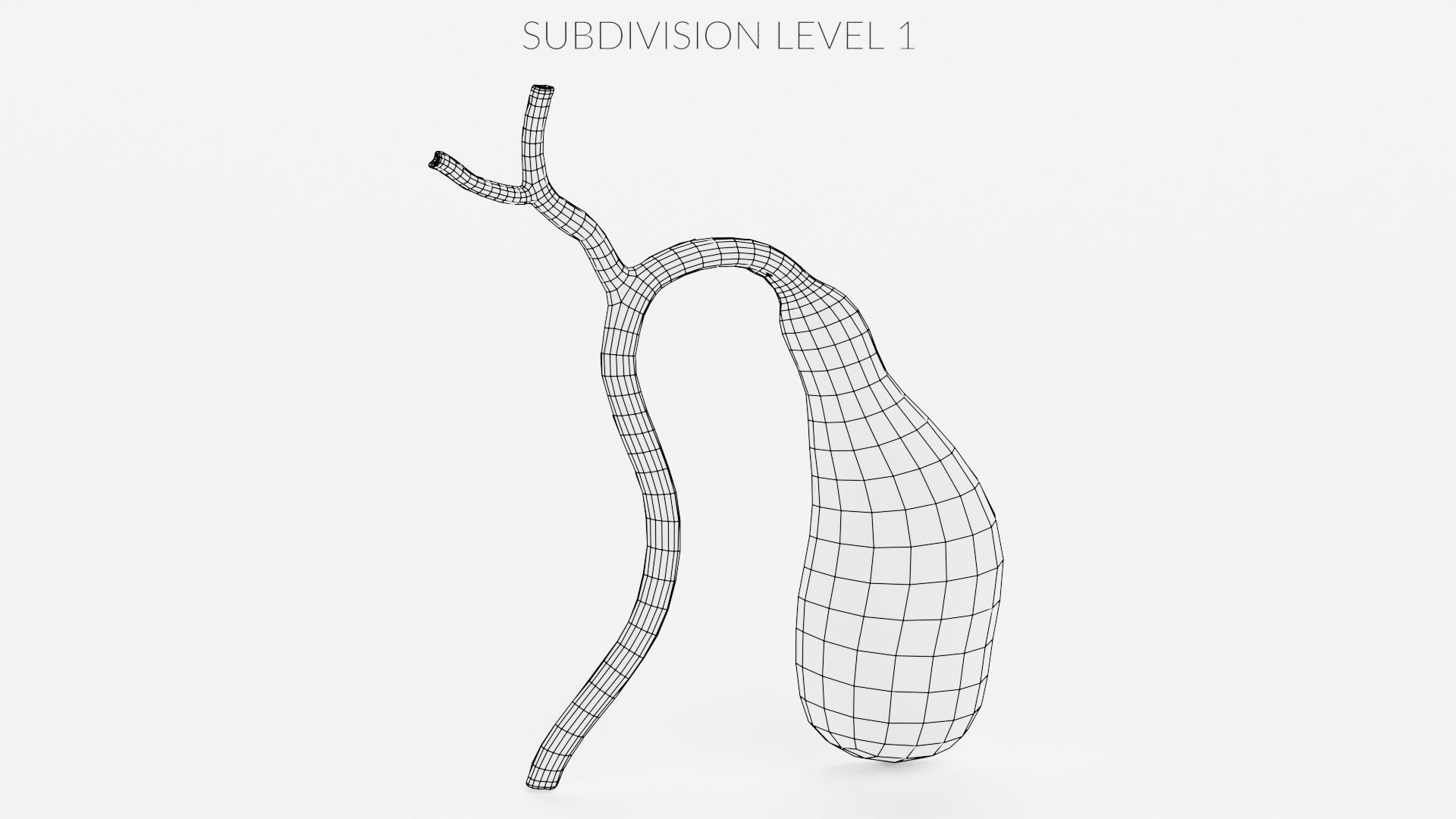 Gallbladder with Gallstones model - TurboSquid 1756732