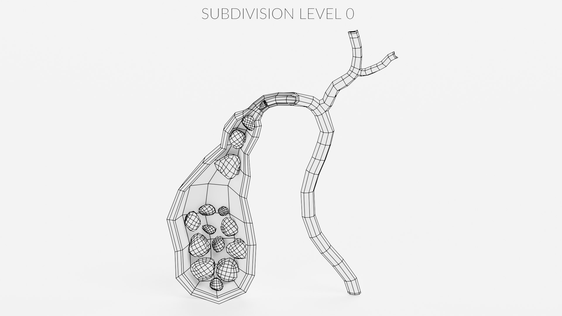 Gallbladder with Gallstones model - TurboSquid 1756732
