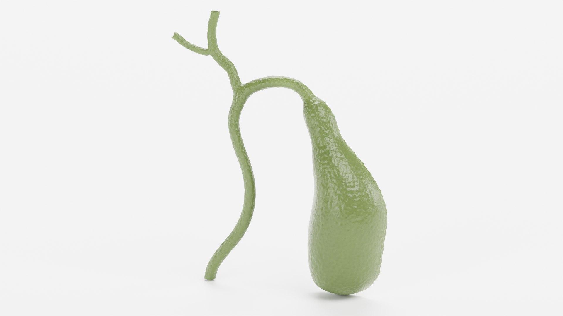 Gallbladder with Gallstones model - TurboSquid 1756732