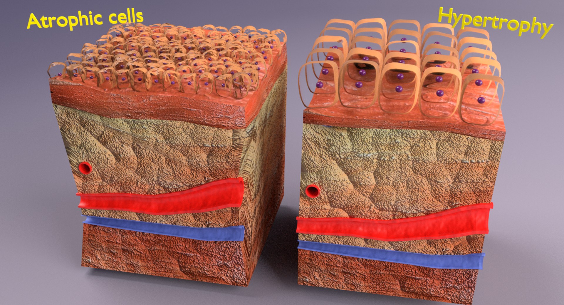 Epithelial Cell Changes 3D - TurboSquid 1323292