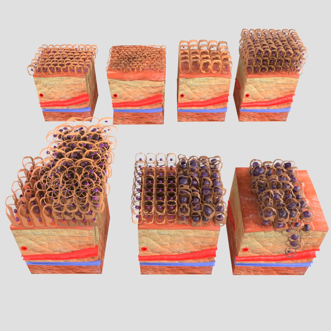 Epithelial cell changes 3D - TurboSquid 1323292