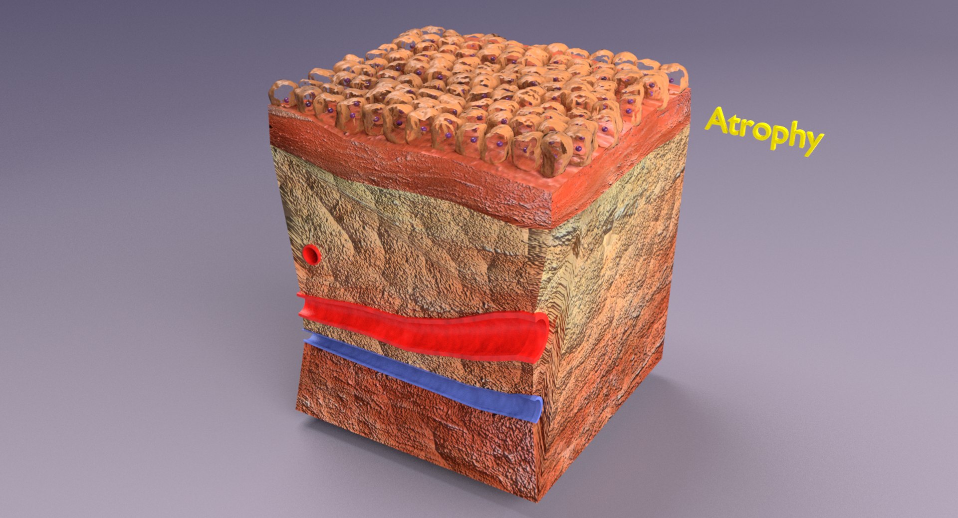 Epithelial Cell Changes 3D - TurboSquid 1323292