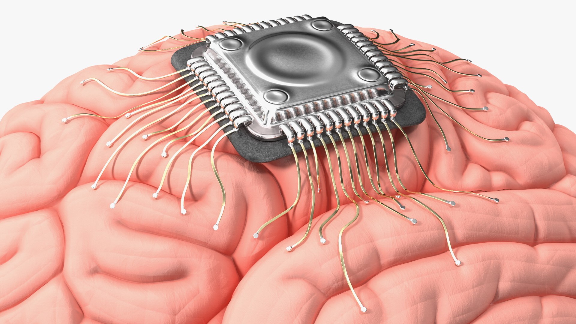 Human Brain With Implanted Microchip 3D Model - TurboSquid 2262580