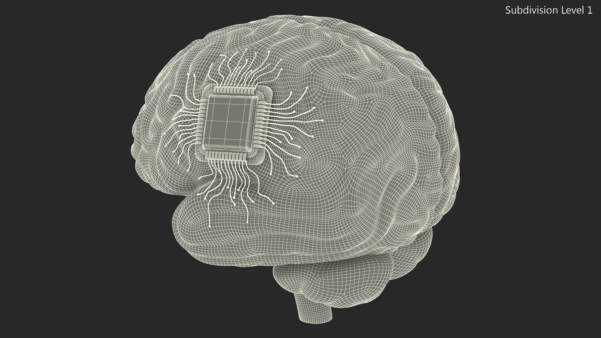Human Brain With Implanted Microchip 3D Model - TurboSquid 2262580