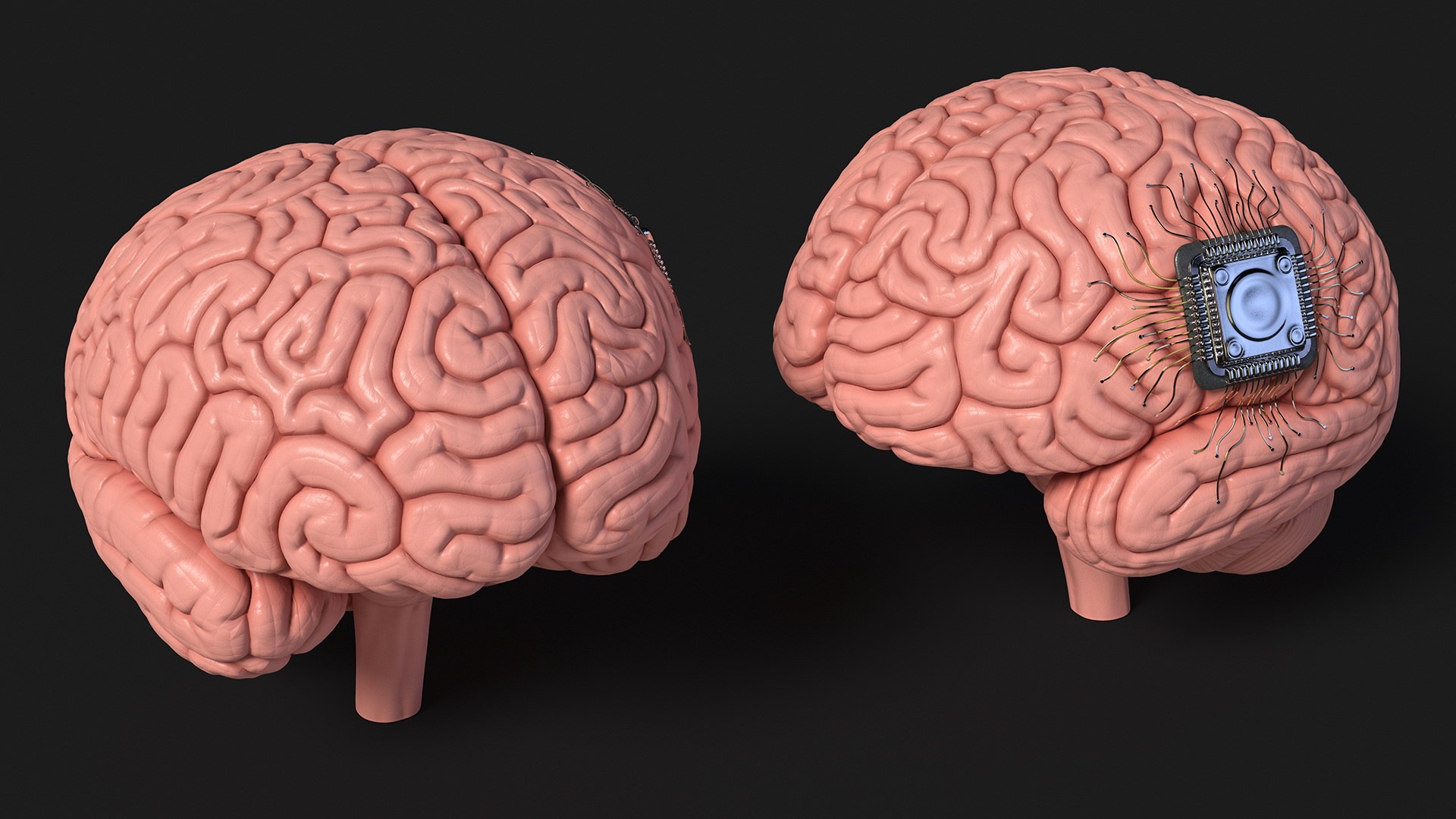 Human Brain With Implanted Microchip 3D Model - TurboSquid 2262580
