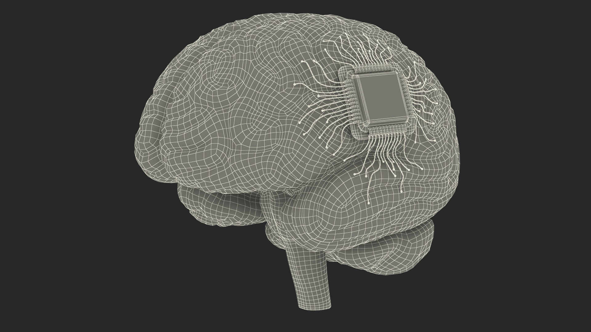 Human Brain With Implanted Microchip 3D Model - TurboSquid 2262580