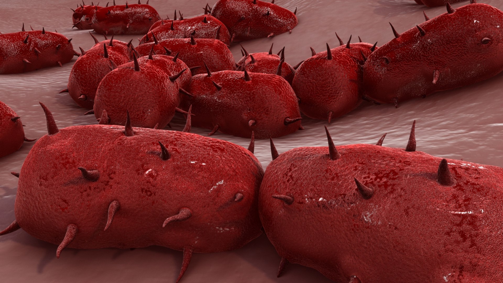 Bacterial Meningitis 3d Model