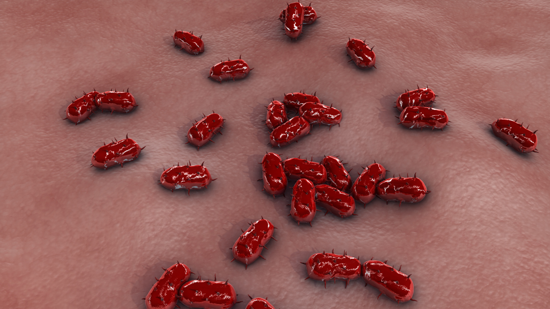 Bacterial Meningitis 3d Model