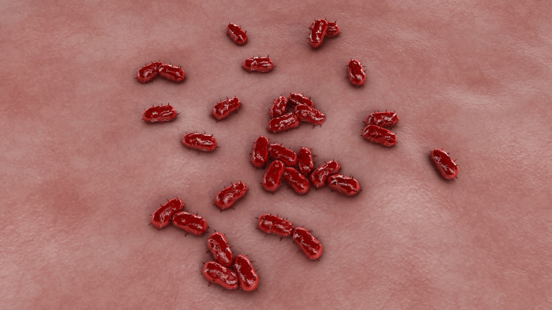 Bacterial Meningitis 3d Model