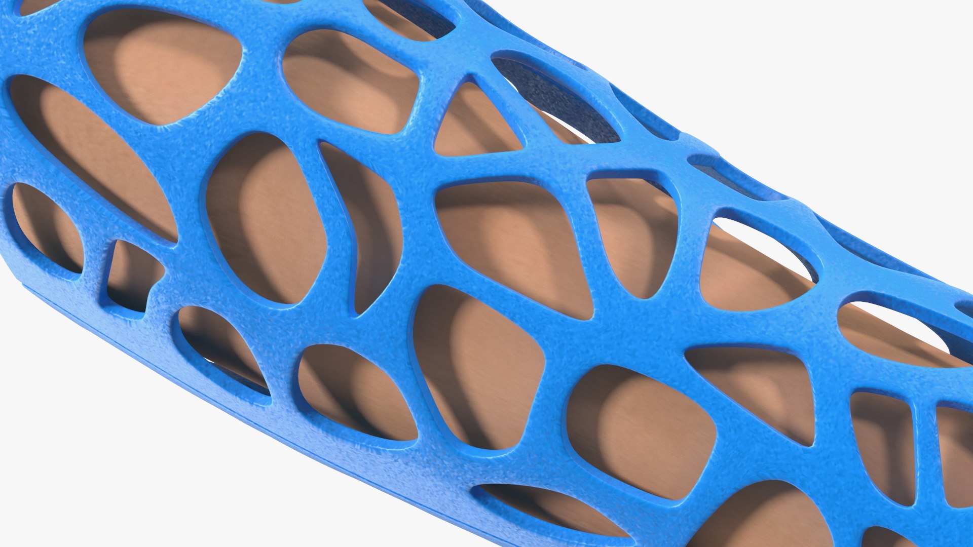 3D 3D-Printed Orthopedic Cast On Hand - TurboSquid 1900345