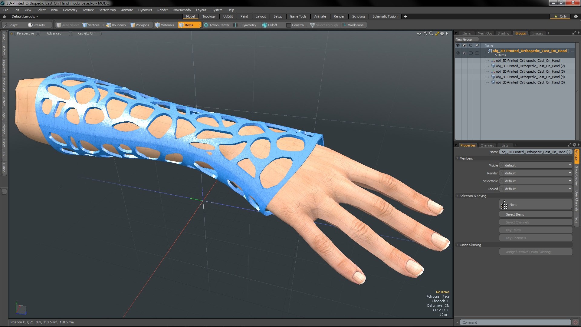 3D 3D-Printed Orthopedic Cast On Hand - TurboSquid 1900345
