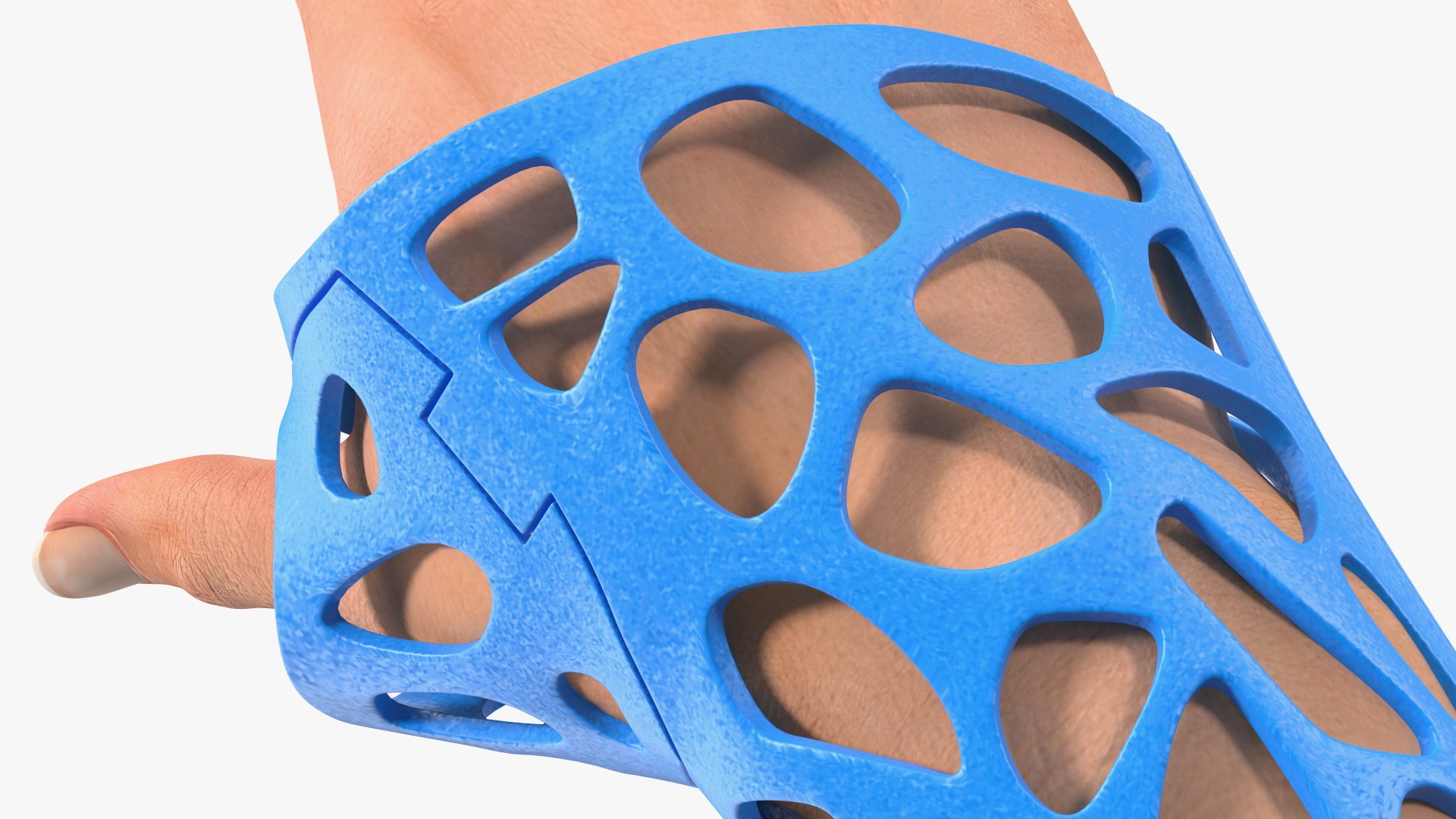 3D 3D-Printed Orthopedic Cast On Hand - TurboSquid 1900345