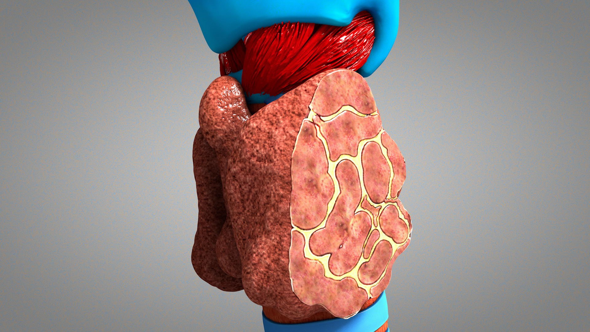 Thyroid Gland 3D Model - TurboSquid 1282526