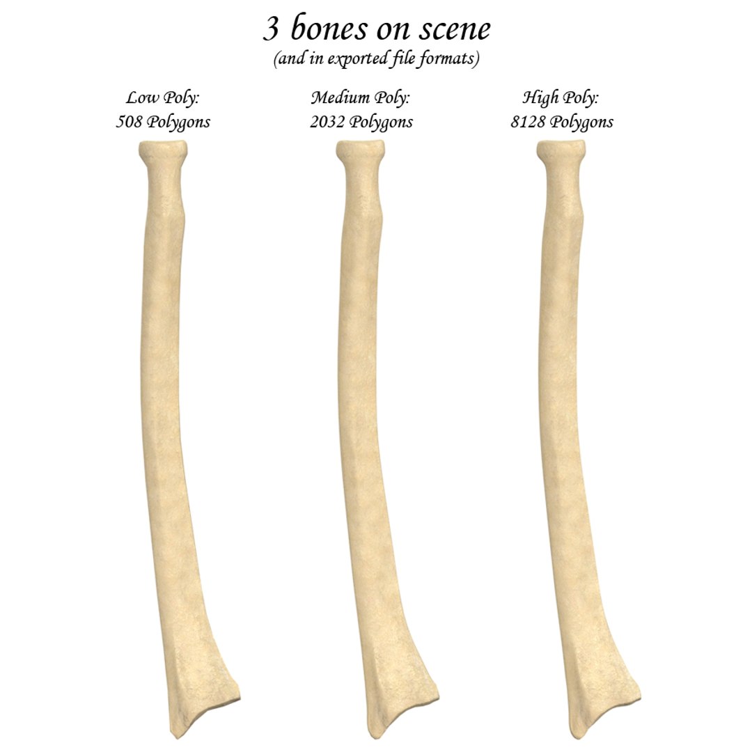 Max Radius Bone