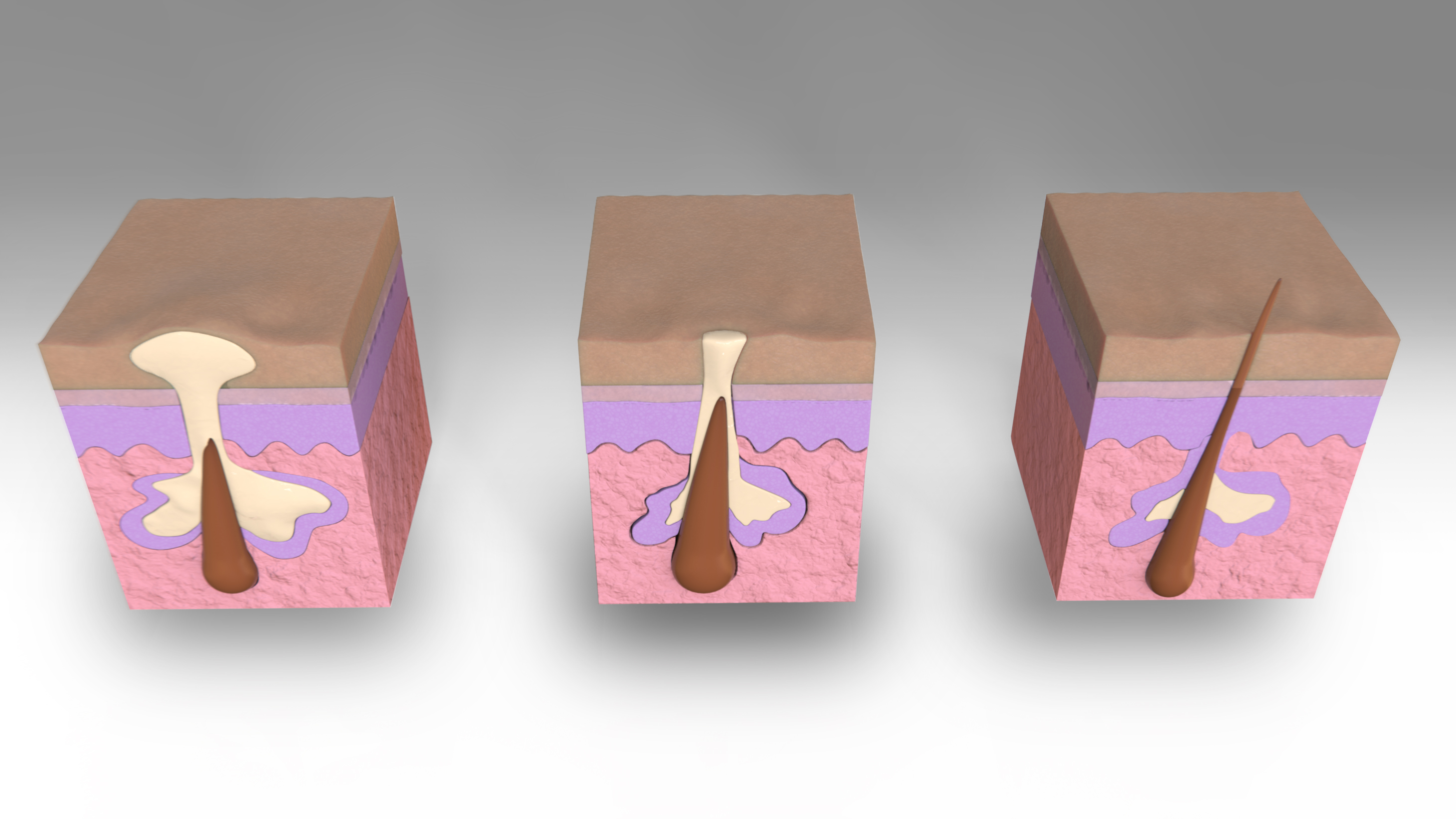3D human skin hair - TurboSquid 1507084