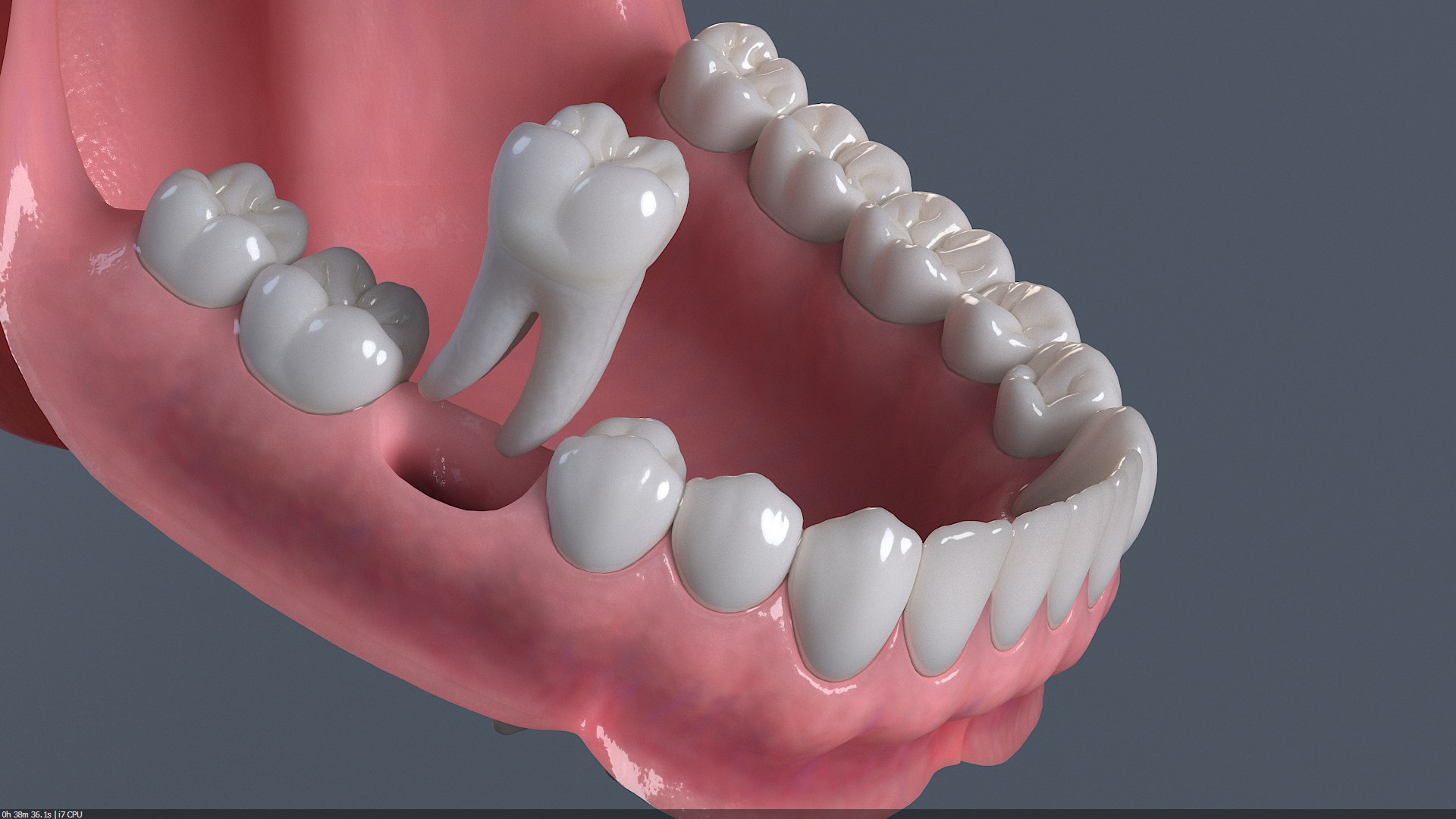 Teeth With Head 3D Model - TurboSquid 2345191